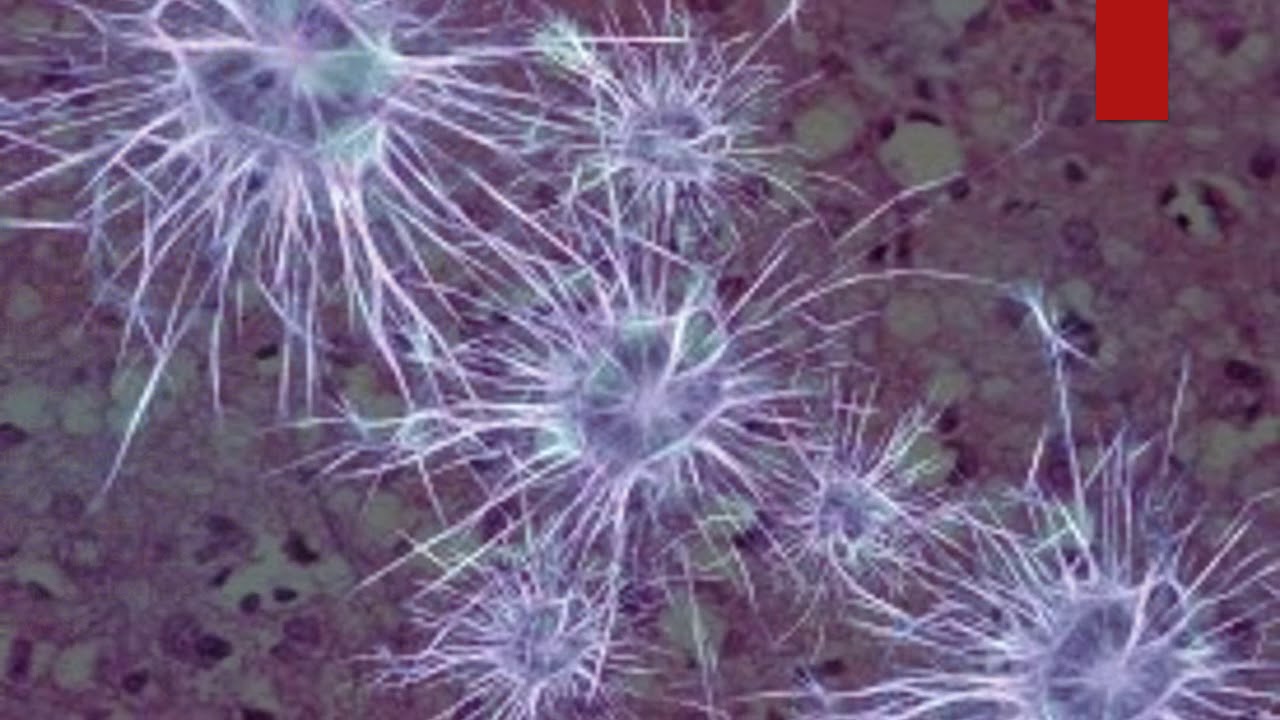 3. Infecciones Víricas - YouTube