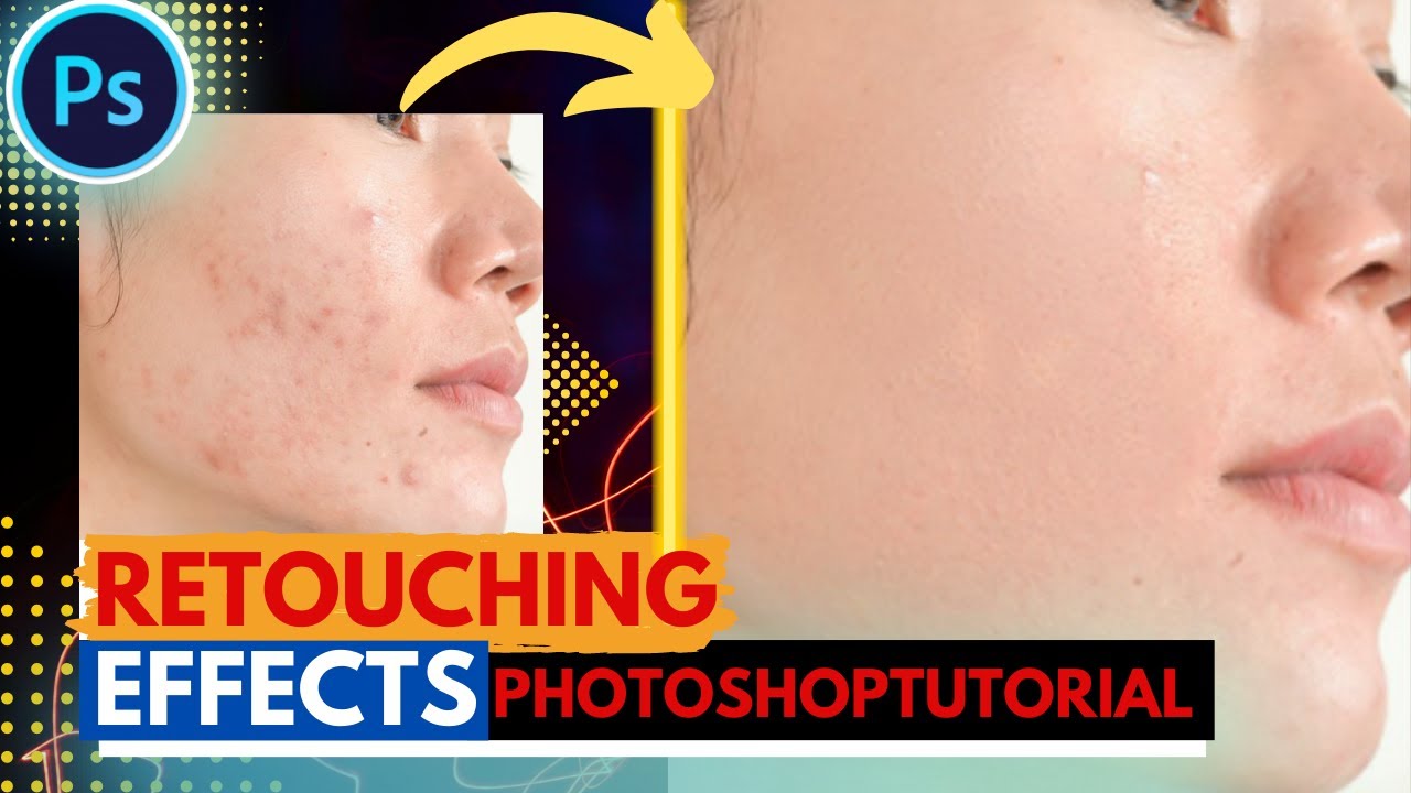 Photoshop Tutorial: High-End Retouching of Rough Skin -Remove Blemishes ...