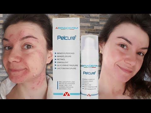 Cosméticos para acne no rosto | "Remedinhos para a pele" #acneadulta ...