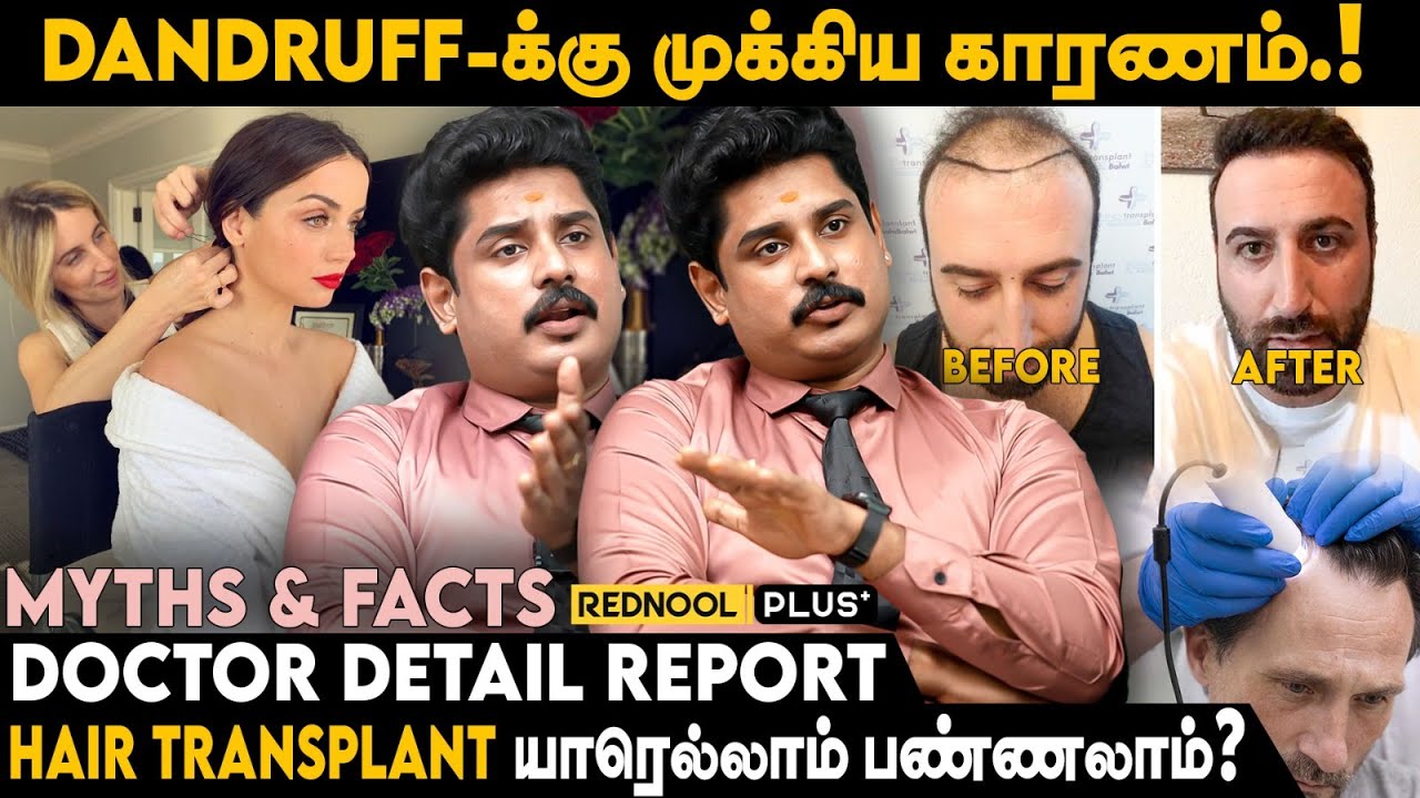 Hair Loss பிரச்சனைக்கு உடனடி தீர்வு.! - விளக்கும் Dr.Ram | Hair Care ...