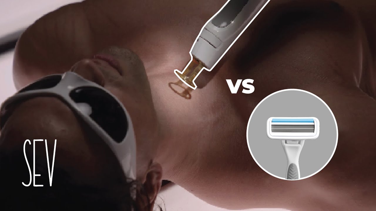 Laser Hair Removal Vs. Shaving – Which Is Better for Smooth, Hair-Free ...