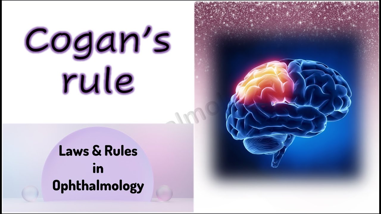 Cogan’s Rule | Laws & Rules in Ophthalmology - YouTube