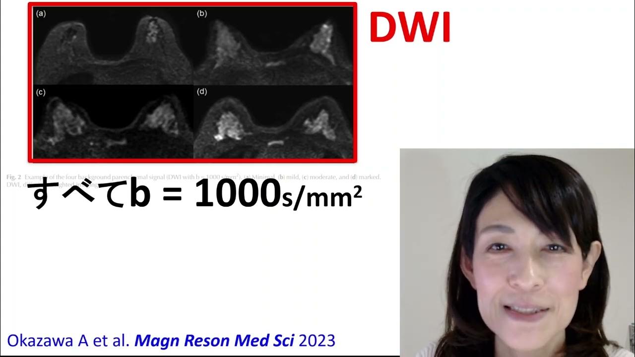 乳房DWIBSを知ろう。【中編】DWIの知られざる真実 - YouTube