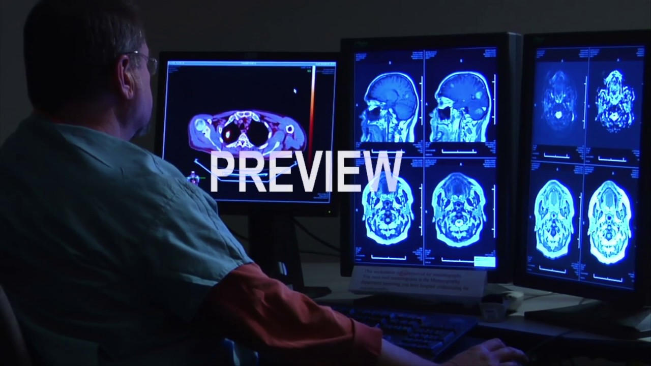 radiologist watching monitors of brain scan ZJ6pzmlZB - YouTube