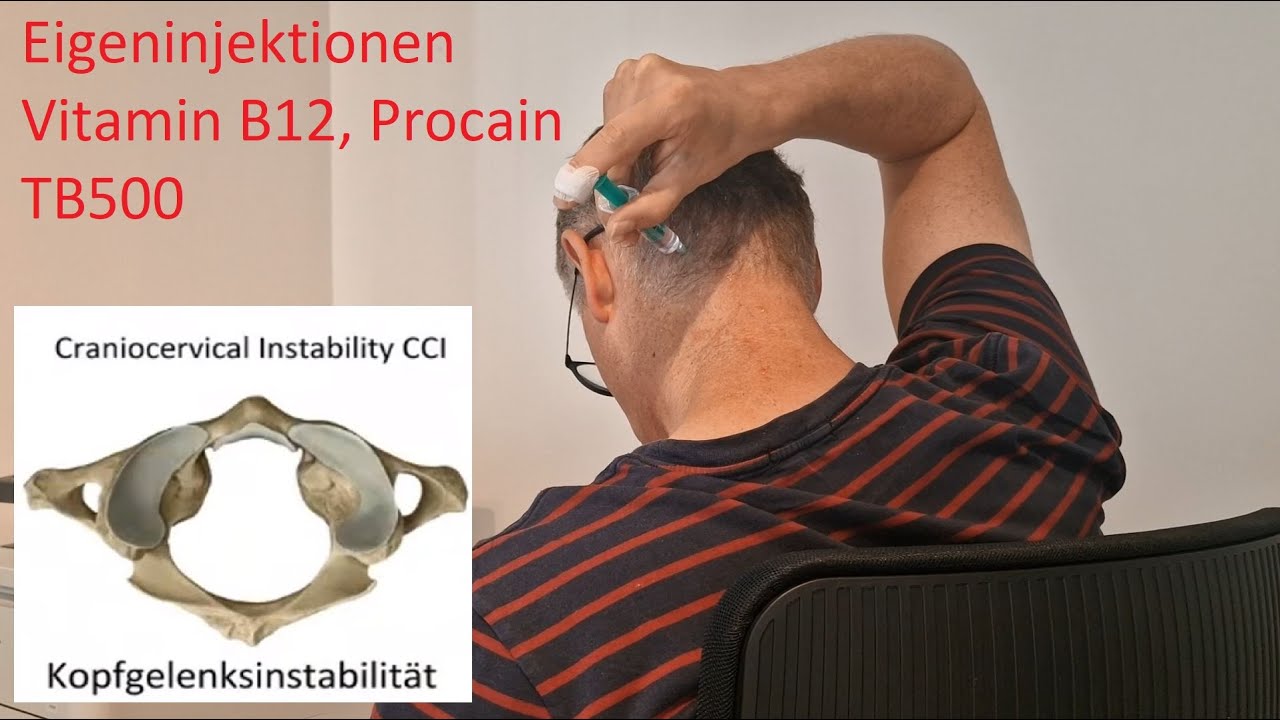 Eigeninjektion - TB500, B12, Procain-Neuraltherapie - YouTube