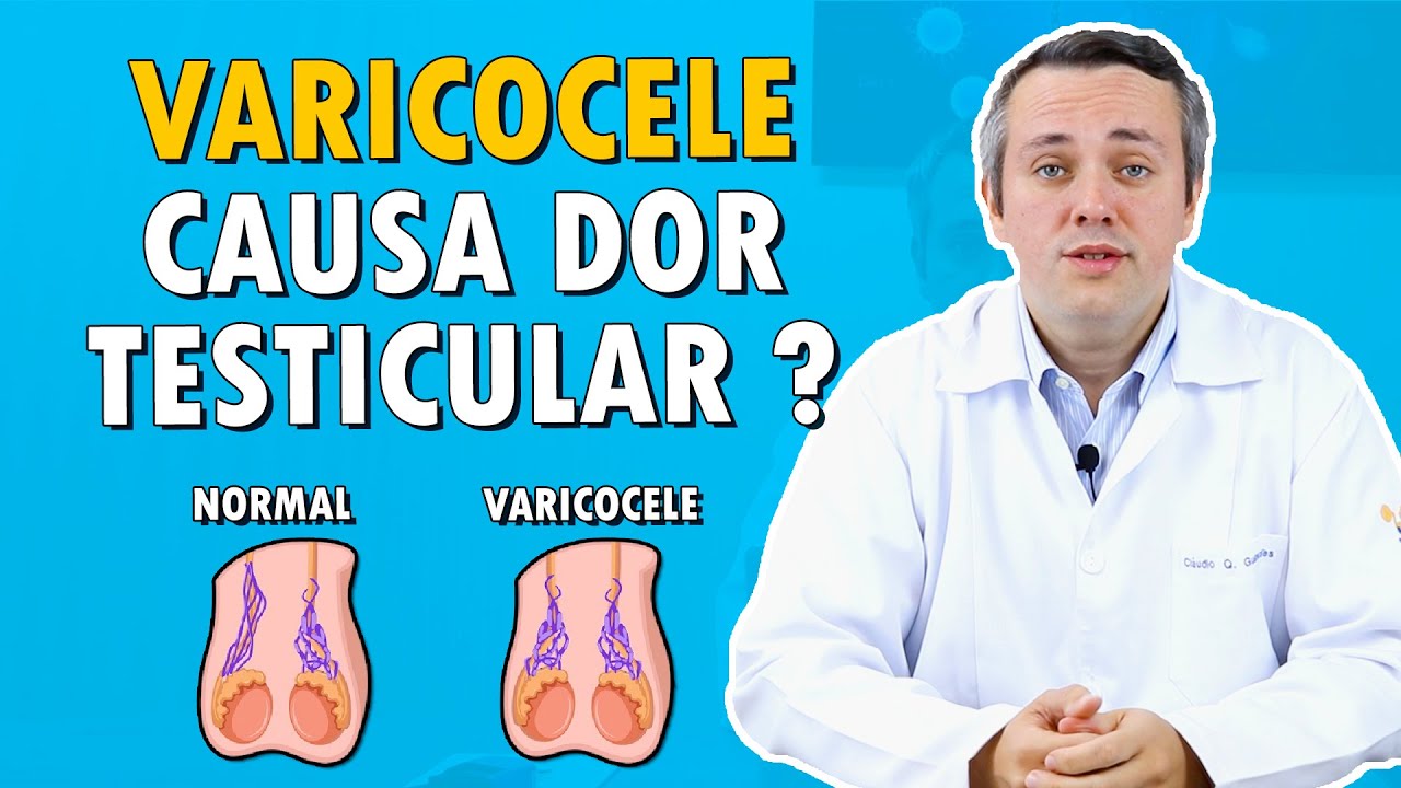 Varicocele Causa Dor No Testículo? | Dr. Claudio Guimarães - YouTube