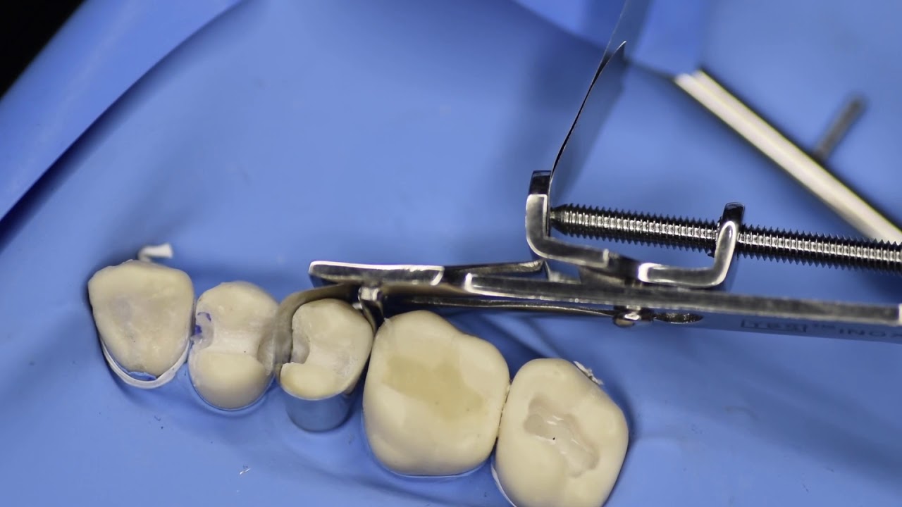 USO CORRECTO DE UNA BANDA MATRIZ - YouTube