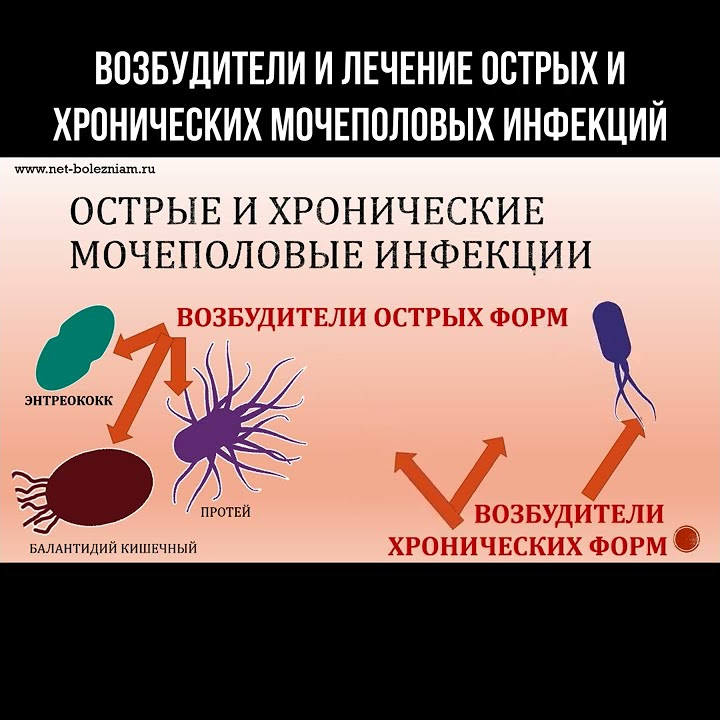 Возбудители и лечение острых и хронических мочеполовых инфекций # ...