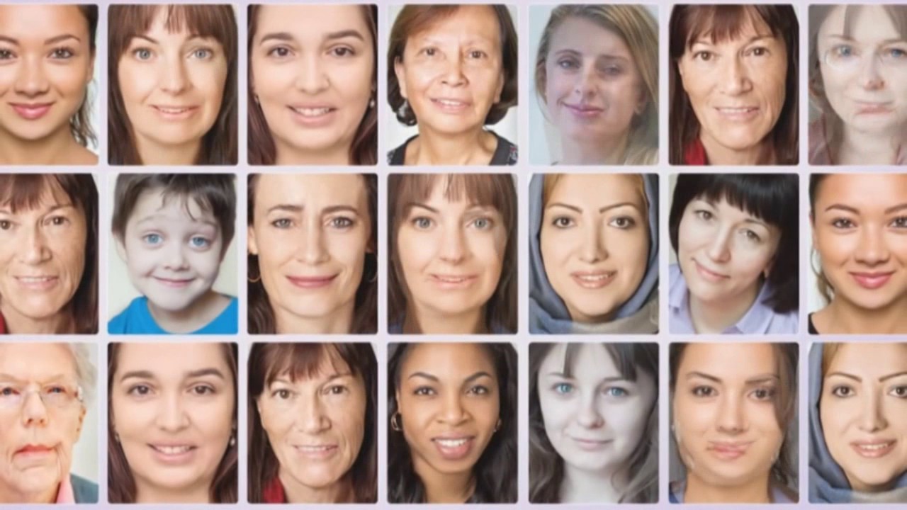 Bem Estar - 24/01/2017 [HD] Paralisia Facial - YouTube