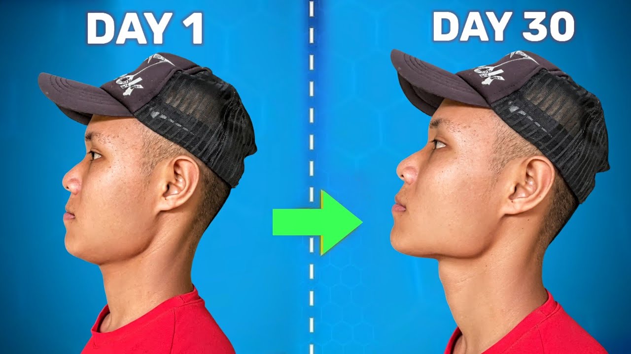 Fix Your Jawline Fast in Just 30 Days - Practical (Proven Results ...