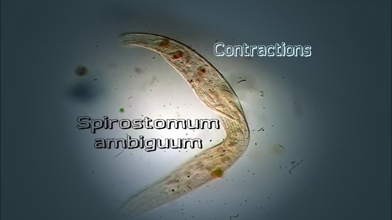 Spirostomum ambiguum contractility - YouTube