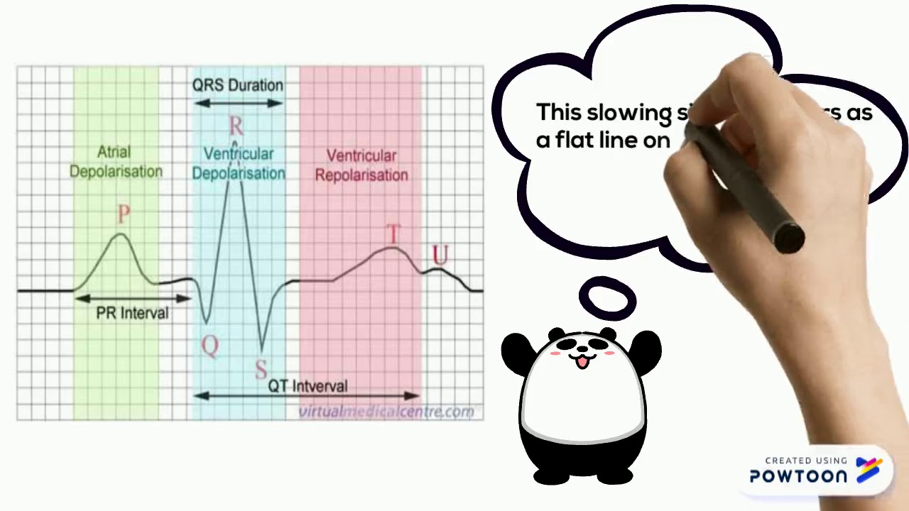 ECG WAVEFORM - YouTube