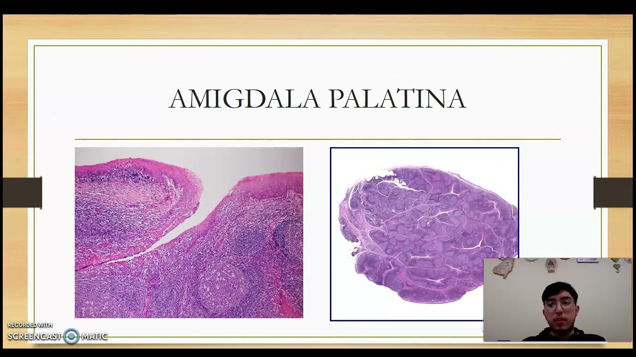 Amigdalas y Placa de Peyer. Video del 2° parcial de Histologia y ...