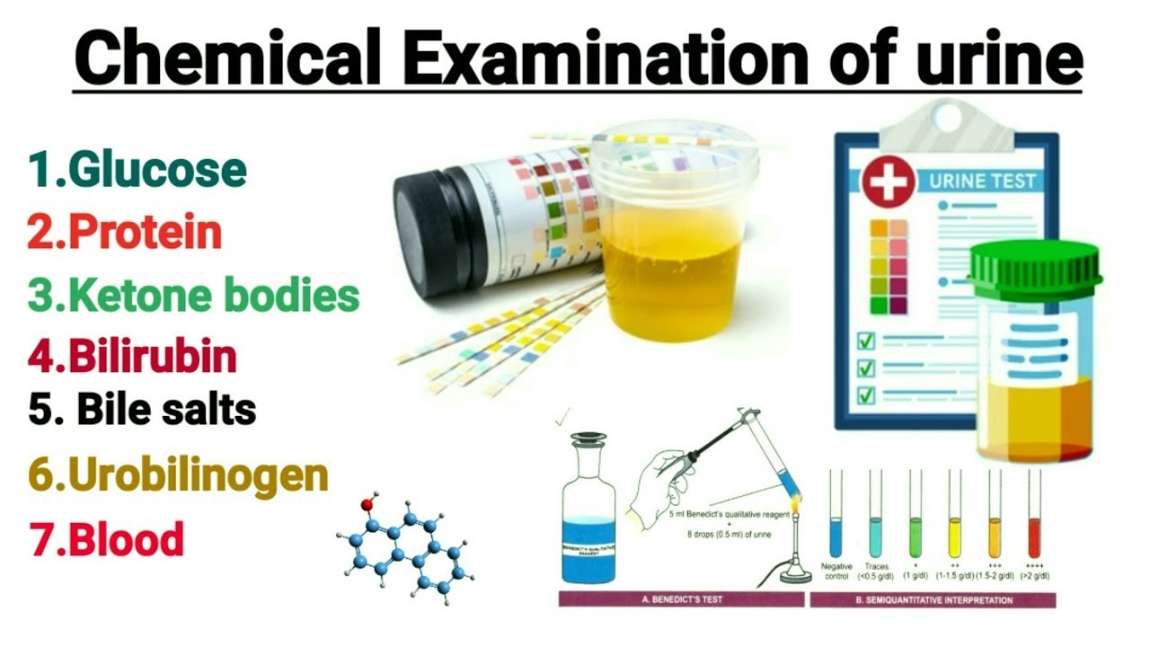 CHEMICAL EXAMINATION OF URINE WITH VIVA VOICE- FOR MBBS AND PG ...