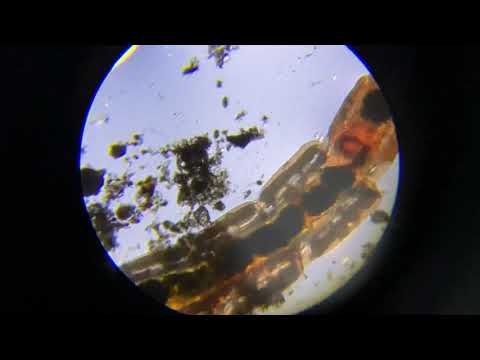 Microscopic Snake - YouTube