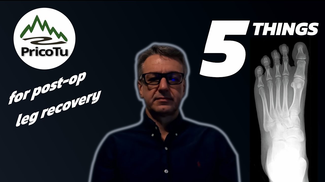 Top 5 Things for Post-Op Leg Injury Recovery - YouTube