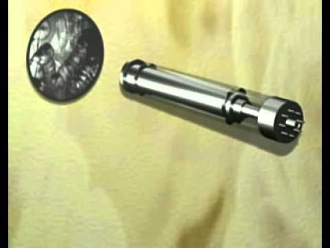 X-ray image intensifier - YouTube