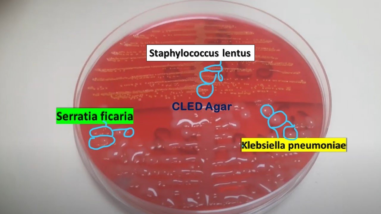 Klebsiella Pneumoniae On Cled Agar