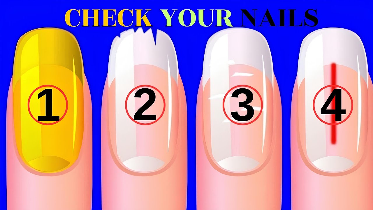 5 Incredible Things Your Nails Can Tell You About Your Health # ...