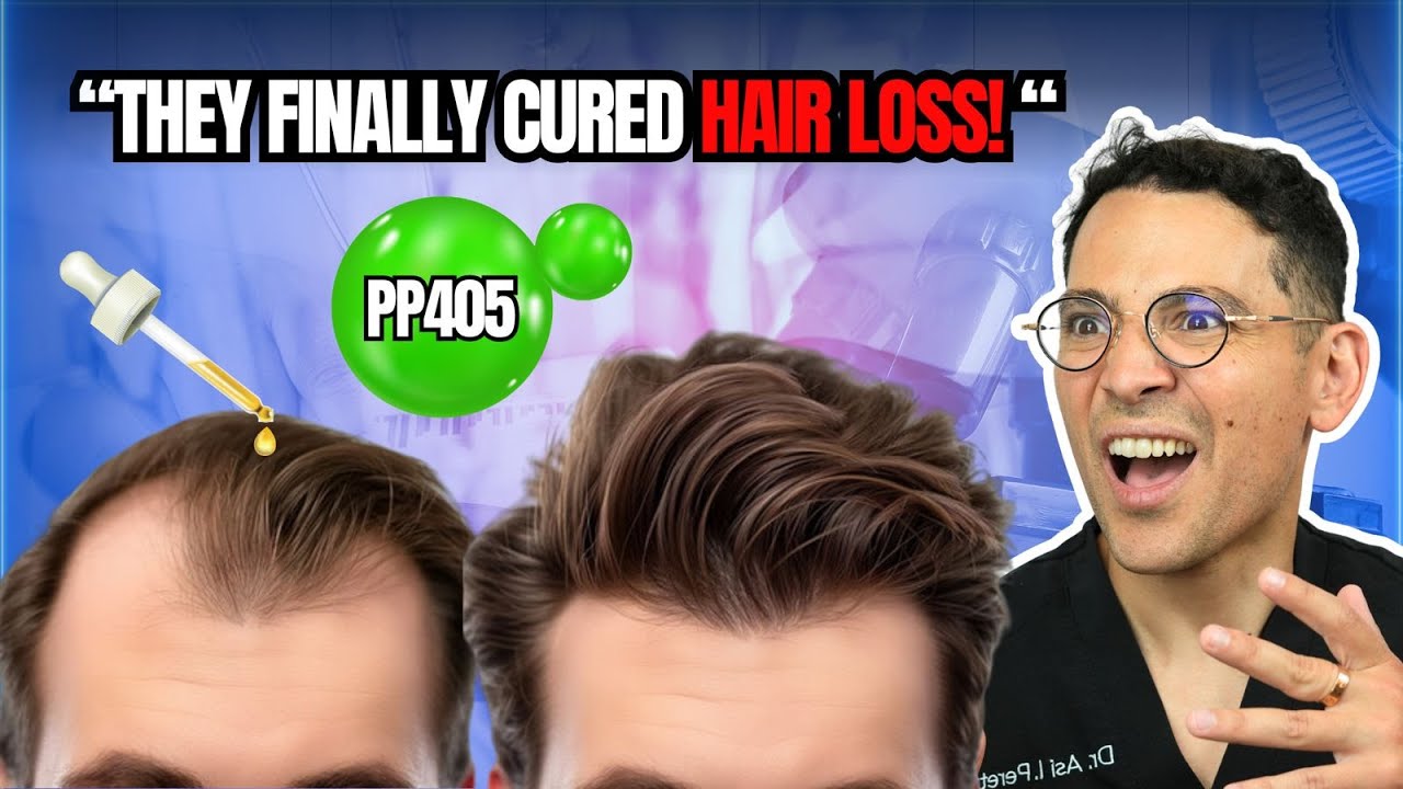 Is PP405 the real cure for balding? - Doctor Explains - YouTube