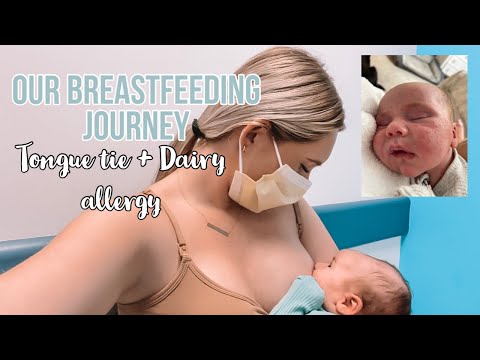 BREASTFEEDING JOURNEY VLOG | Newborn tongue tie & Dairy Allergy | Alexis Green