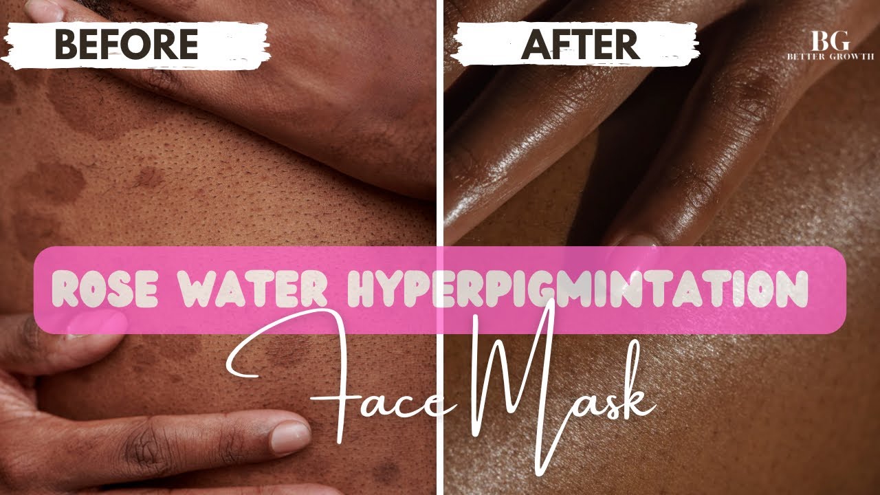 Rose Water Hyperpigmintation Gel Face Mask | Formula INCLUDED | Skincare Business - YouTube