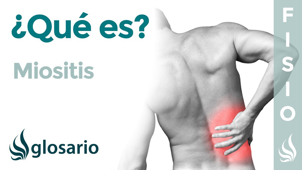 MIOSITIS | Qué es, qué afecta, síntomas, signos clínicos, causas y ...