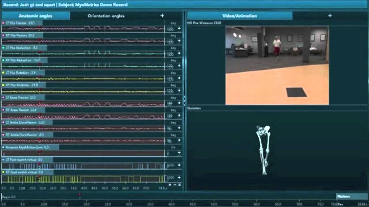 PTI's MyoMOTION by NORAXON - YouTube