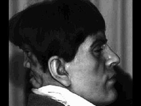 creepypasta - el hombre con 2 caras Edward Mordrake - YouTube