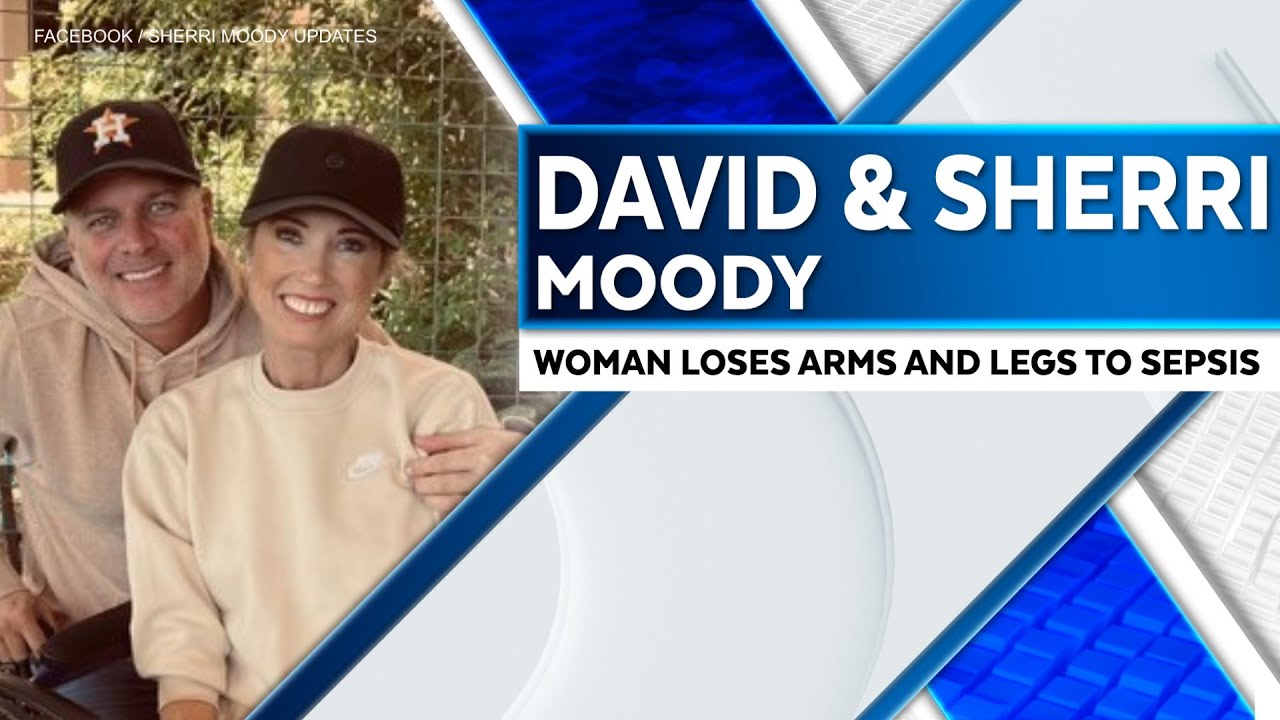 Woman Who Lost Arms and Legs to Sepsis Shares Her Story of Recovery ...