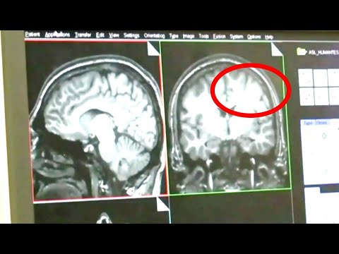 This Neuroscientist Wakes Up From A Week Long Coma & Reveals The Truth ...