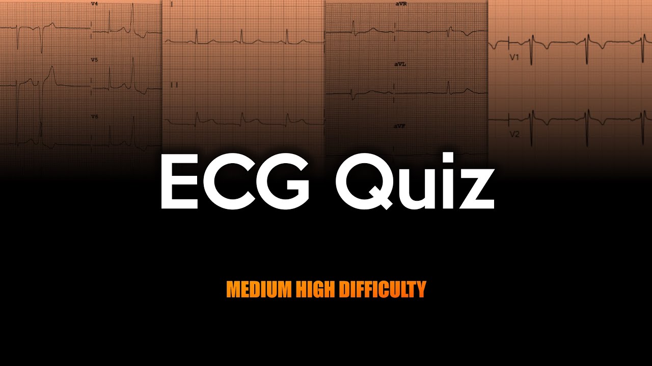 ECG Quiz: Medium to High Difficulty - YouTube