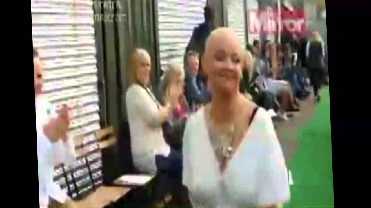 Alton Towers amputee Vicky Balch hits the catwalk after fearless ...