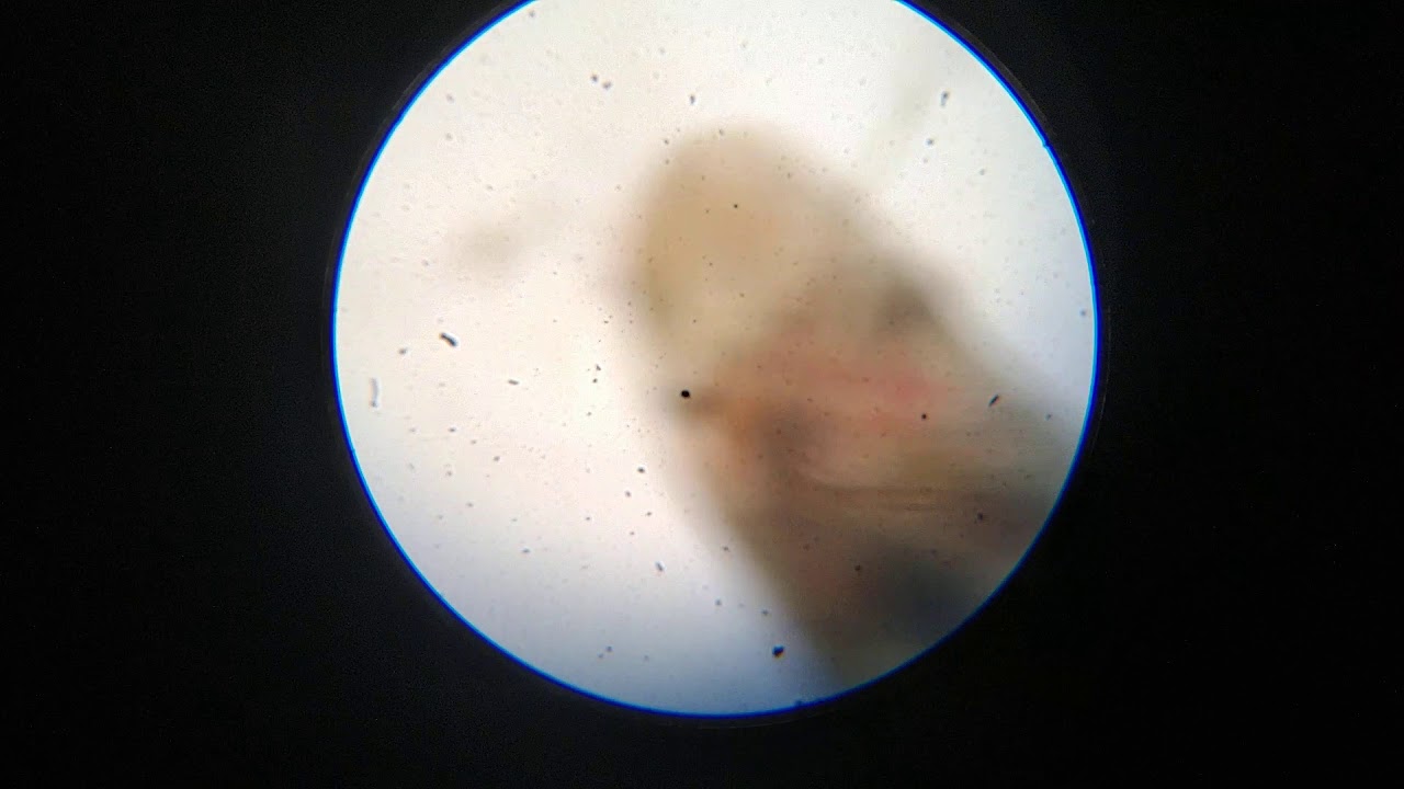Micro organisms under simple microscope - YouTube