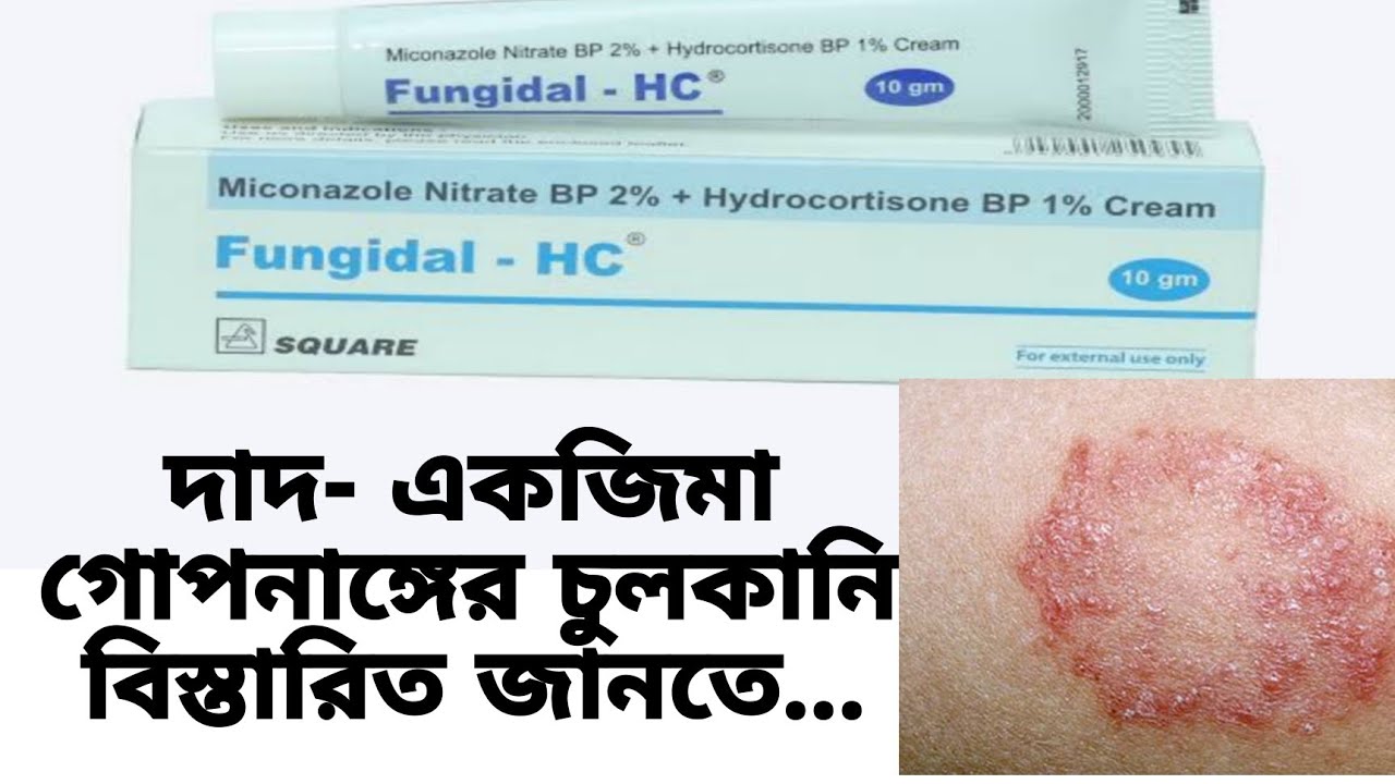 Fungidal HC Cream Review চুলকানি ও একজিমা Fungidal HC Cream এর ব্যবহার ...