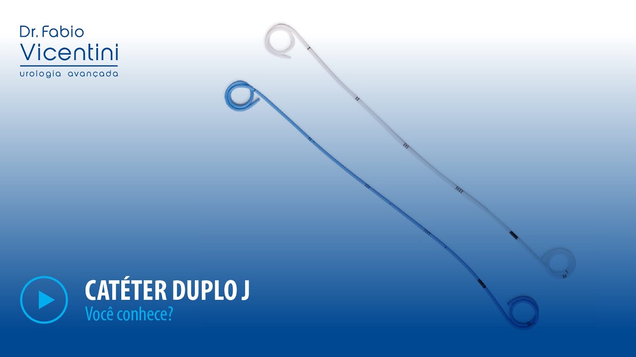 Cateter Duplo J: saiba quando o procedimento é indicado - YouTube