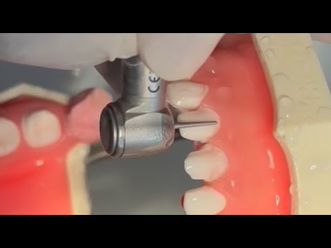All ceramic tooth preparation Easy way to Perfect your preparation ...