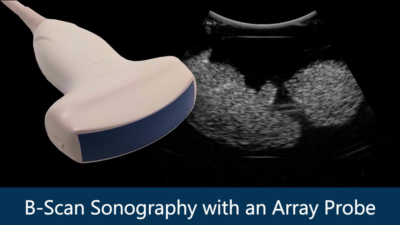 B-Scan Sonography with an Array Probe - YouTube