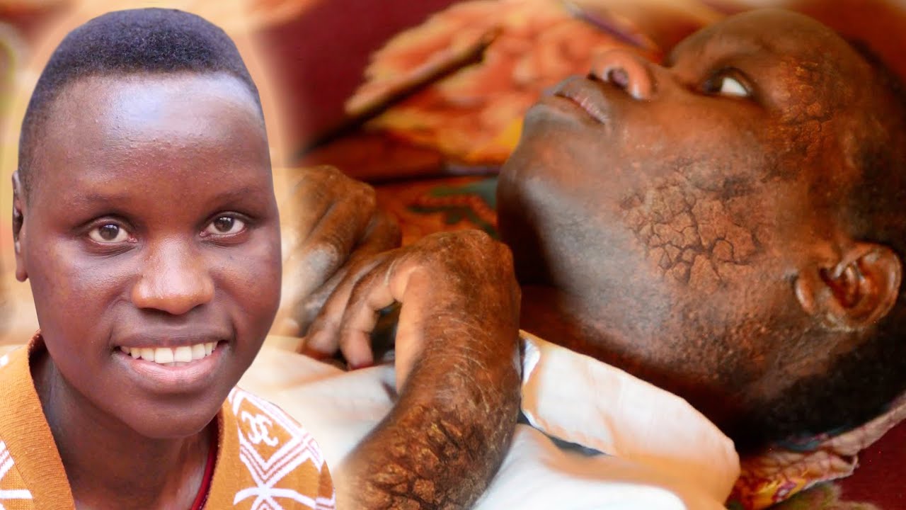 She Was Slowly Turning Into a Tree and This Happened | NONE BELIEVES ...