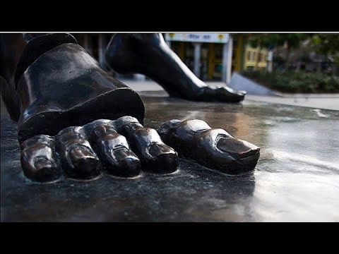 What is AINHUM|ainhum means #shorts - YouTube