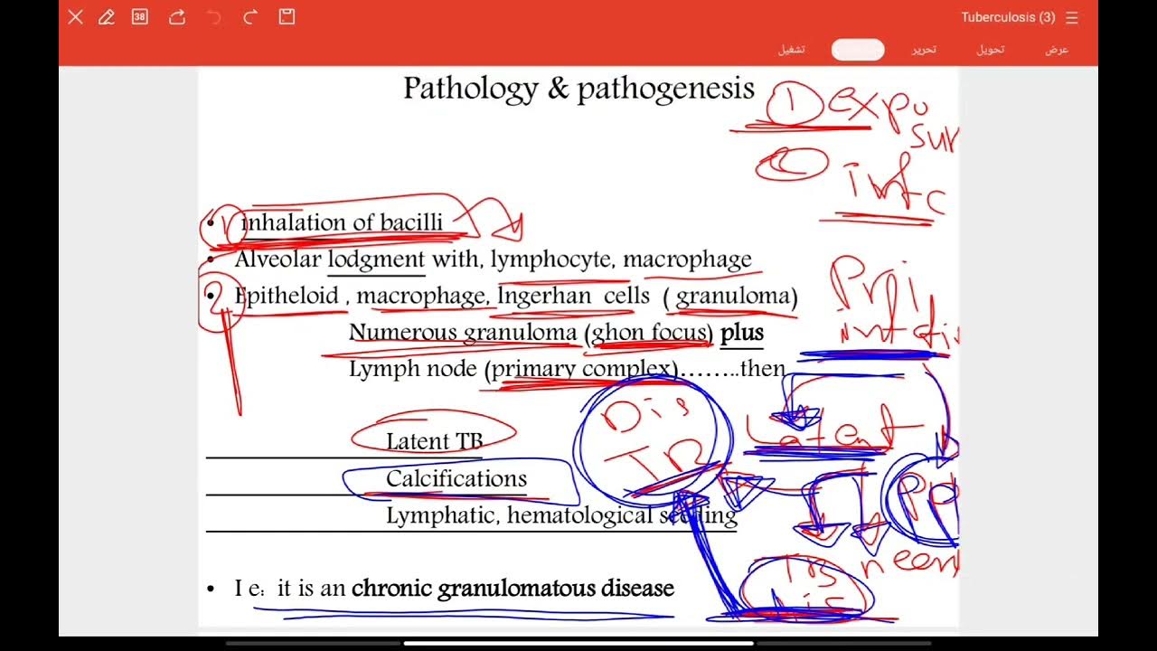 Tuberculosis lecture 1, part 2 - YouTube