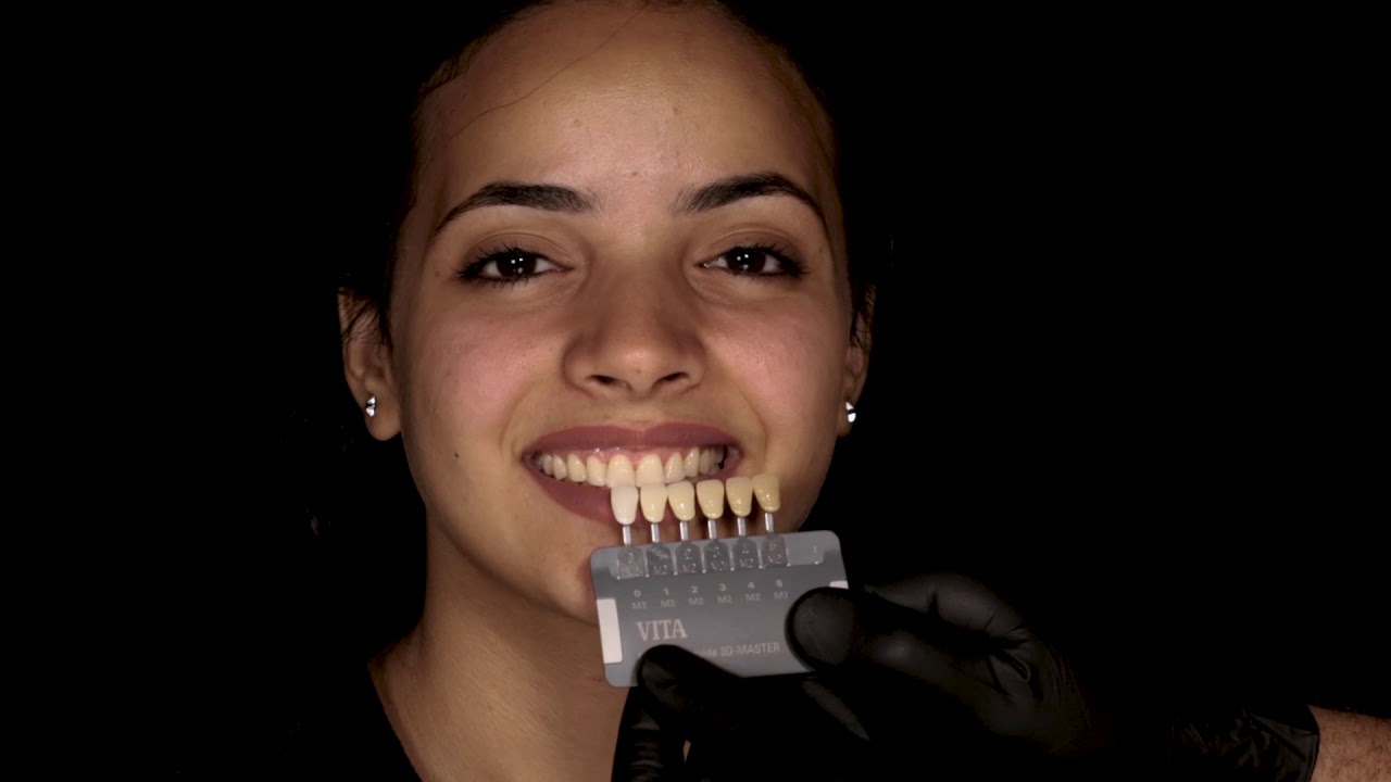 Part 1: Different shade guide Systems.. types and procedures - YouTube