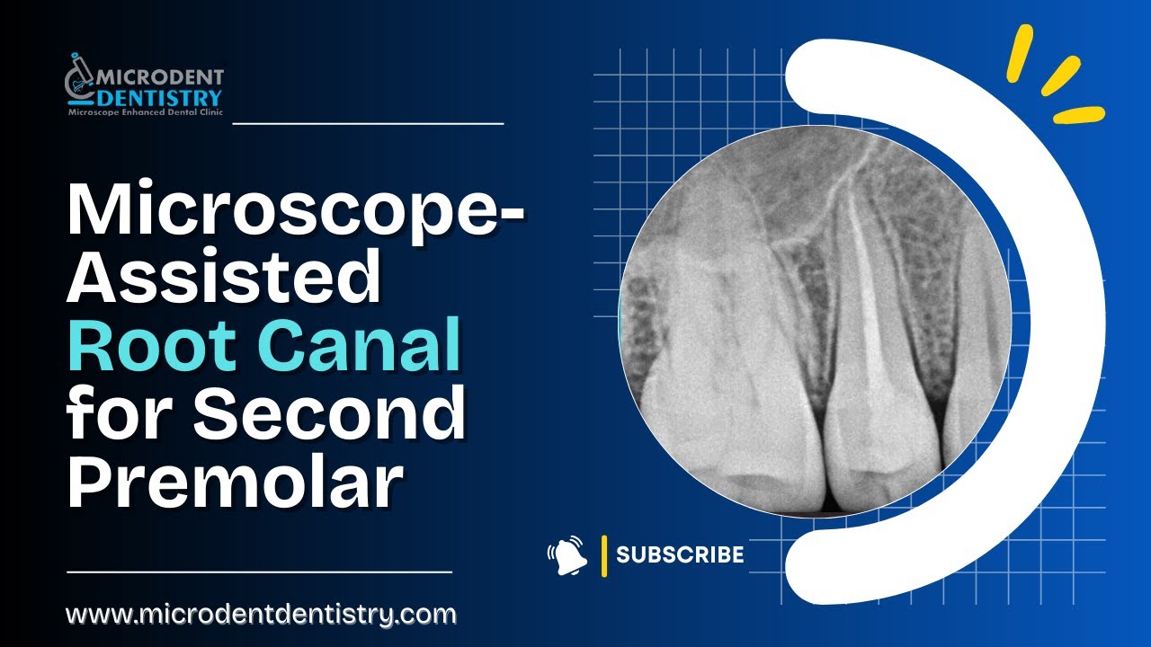 Root Canal Treatment of Second Premolar Using Microscope | Microdent ...