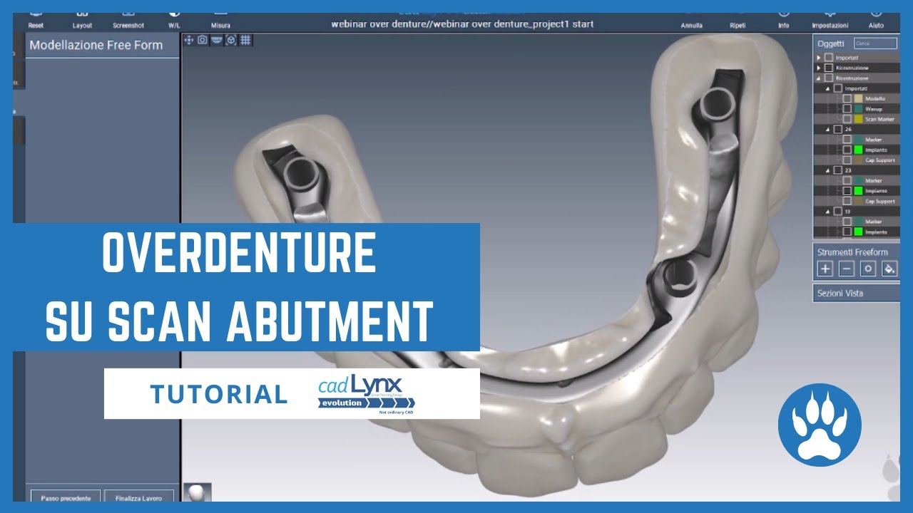 Overdenture da scan abutment con Cad Lynx Evolution - YouTube