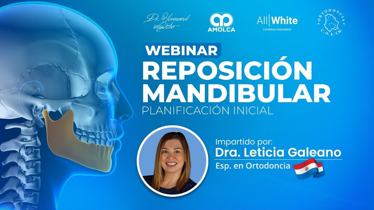 REPOSICIÓN MANDIBULAR | PLANIFICACIÓN INICIAL - YouTube