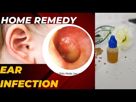Home Remedy for Ear pain - ear infection & otitis | how to relief ear ...
