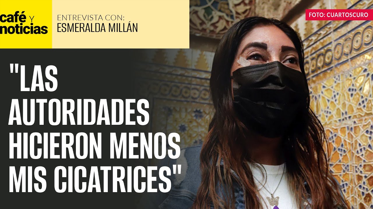 #Entrevista ¬ Costó bastante la Justicia. Hacían menos mis cicatrices ...