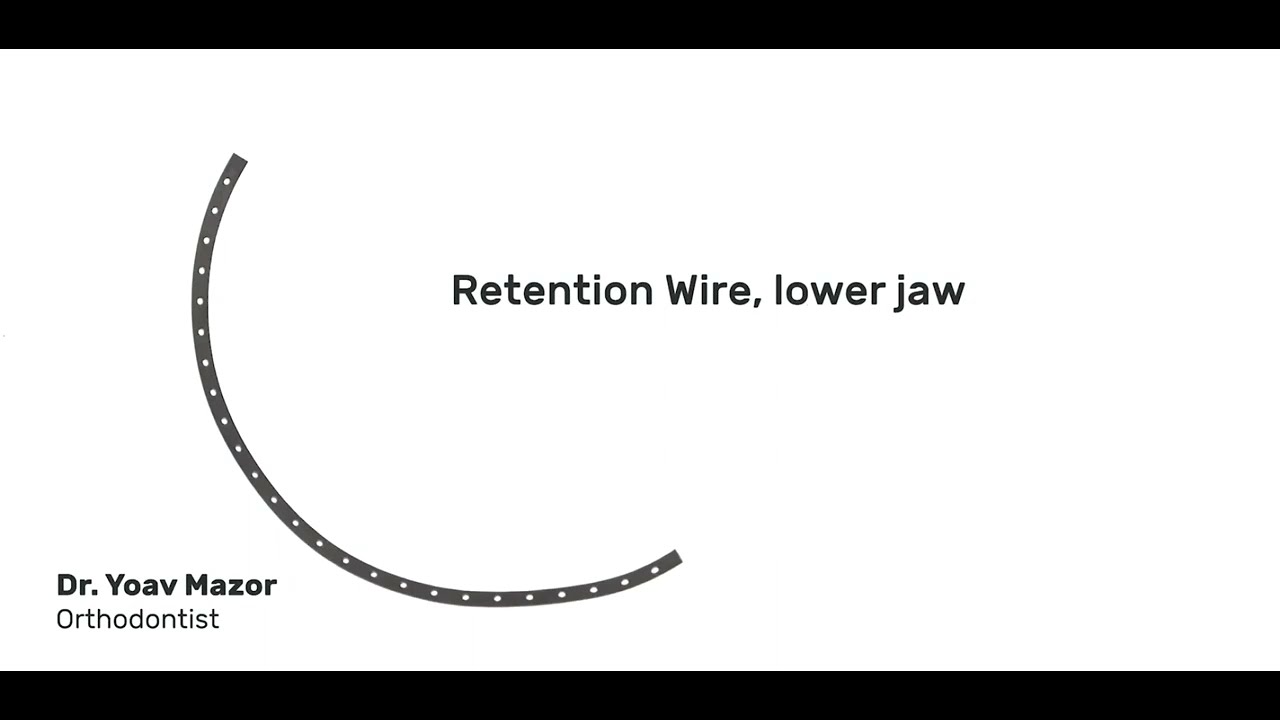 How to Use the Lingual Retention Wire Set - Strauss Diamond - YouTube