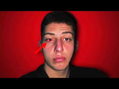 ΤΙ ΕΧΕΙ ΠΑΘΕΙ ΤΟ ΜΑΤΙ ΜΟΥ… 👁️ - YouTube