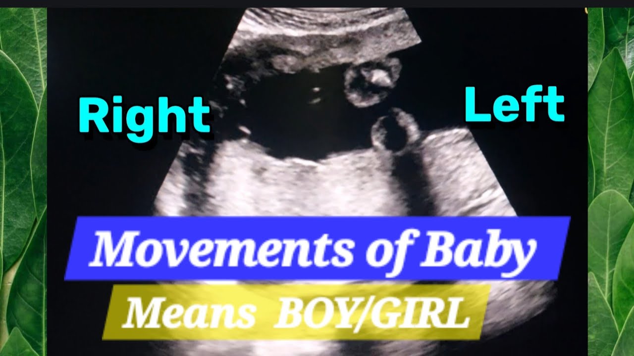 26wk Fetal First Ultrasound | Fetal Movement On Right Side | Posterior ...